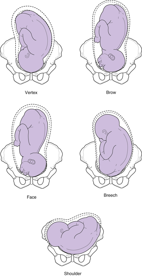 Skills for Midwifery Practice