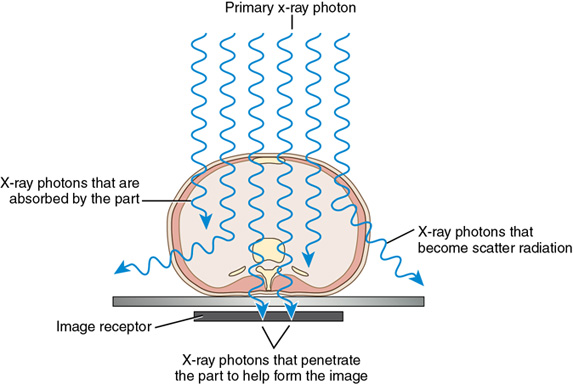 Essentials of Radiographic Physics and Imaging