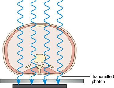 Essentials of Radiographic Physics and Imaging