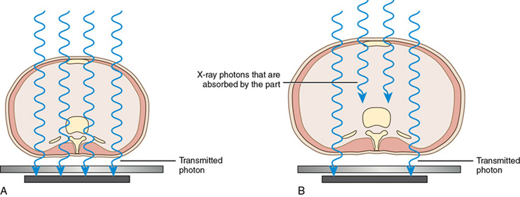 Essentials of Radiographic Physics and Imaging