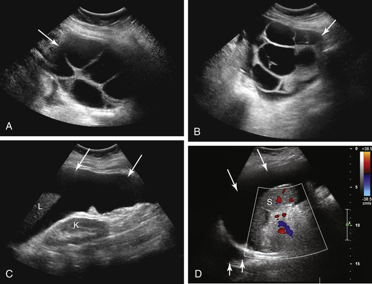Ultrasound