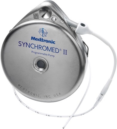 Intraspinal Access and Medication Administration