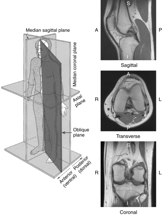 Sectional Anatomy for Imaging Professionals