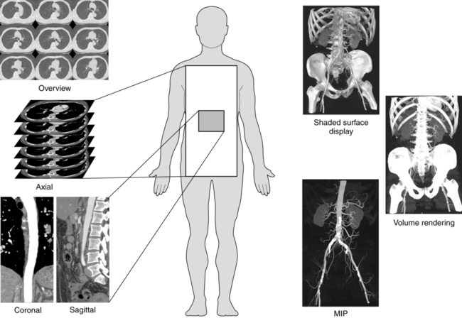 Sectional Anatomy for Imaging Professionals