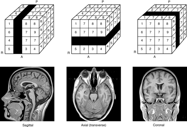 Sectional Anatomy for Imaging Professionals
