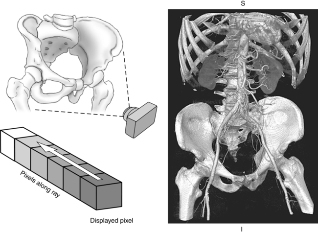 Sectional Anatomy for Imaging Professionals