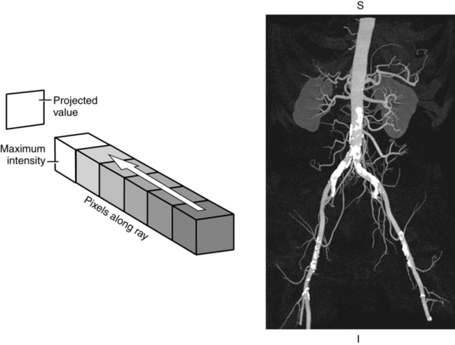 Sectional Anatomy for Imaging Professionals