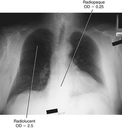 Radiologic Science for Technologists