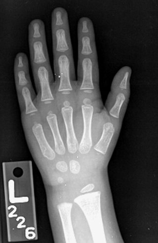 Radiologic Science for Technologists