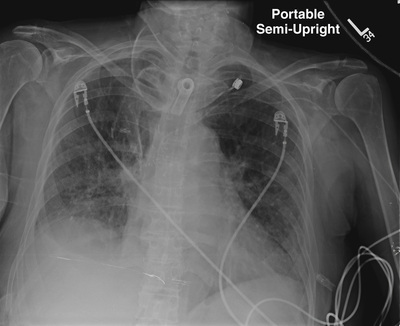 Radiologic Science for Technologists