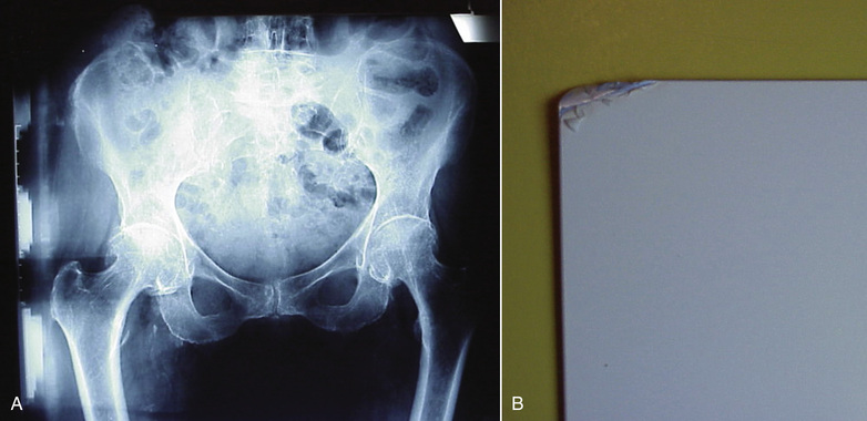 Radiologic Science for Technologists