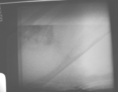 Radiologic Science for Technologists