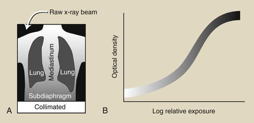 Radiologic Science for Technologists