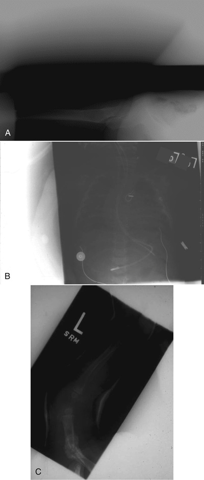 Radiologic Science for Technologists