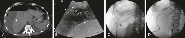 Image-Guided Interventions