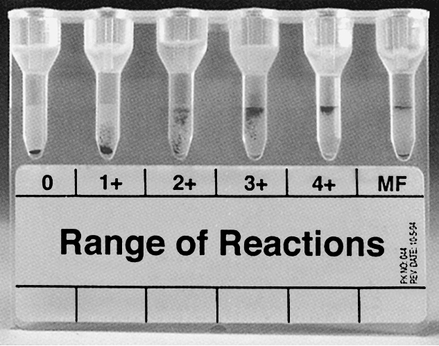 Basic & Applied Concepts of Blood Banking and Transfusion Practices