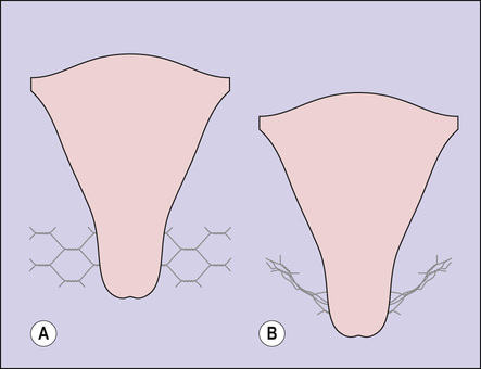 Llewellyn-Jones Fundamentals of Obstetrics and Gynaecology