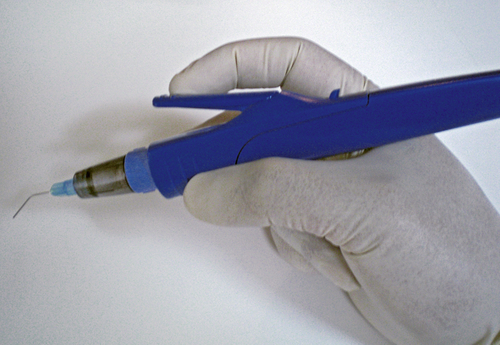 Local Anesthesia for the Dental Hygienist