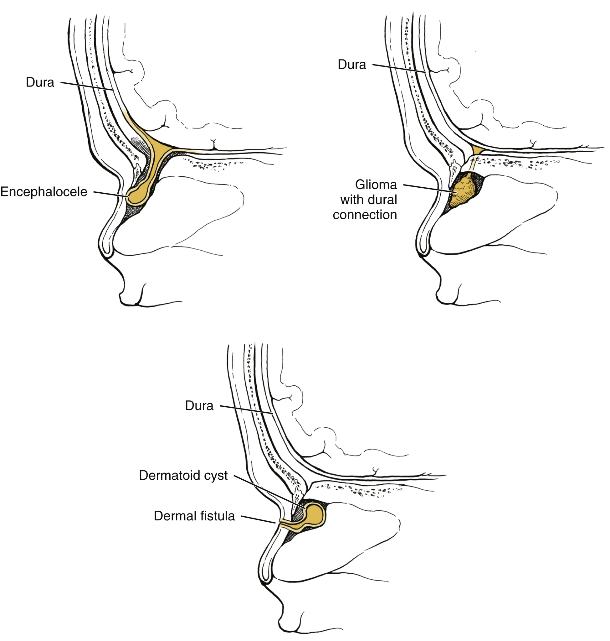Cummings Review of Otolaryngology