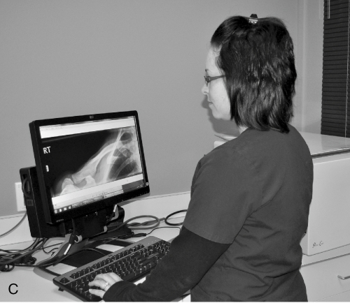 Radiography Essentials : For Limited Practice