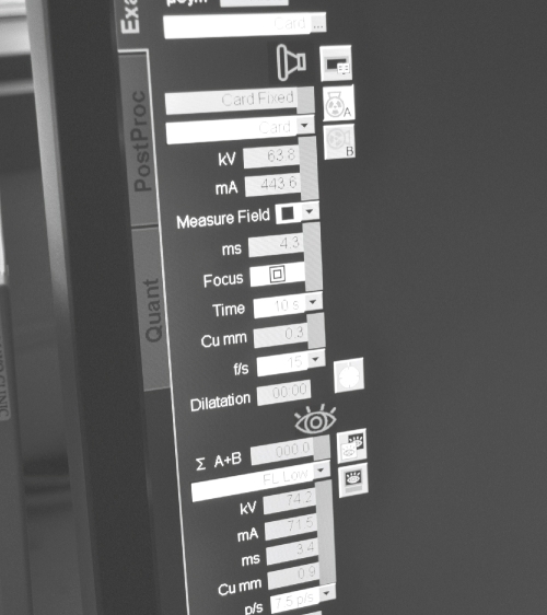 Radiography Essentials : For Limited Practice