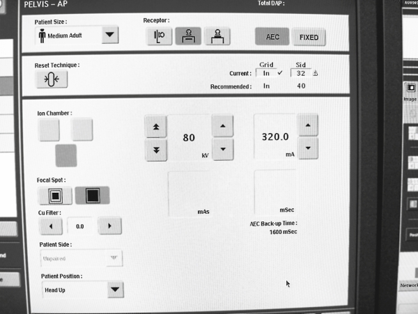 Radiography Essentials : For Limited Practice