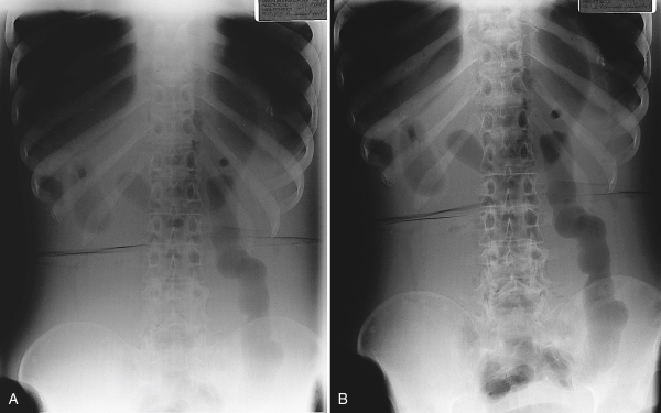 Radiography Essentials : For Limited Practice