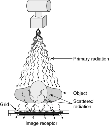 Radiography Essentials : For Limited Practice