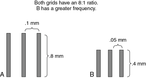 Radiography Essentials : For Limited Practice