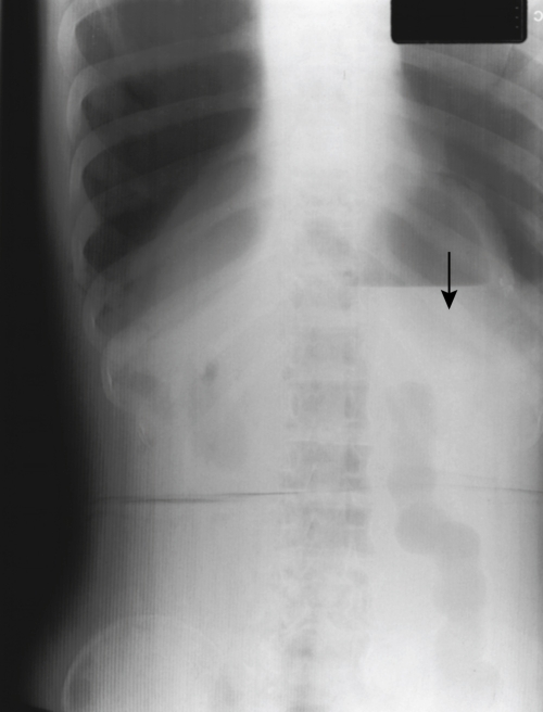 Radiography Essentials : For Limited Practice