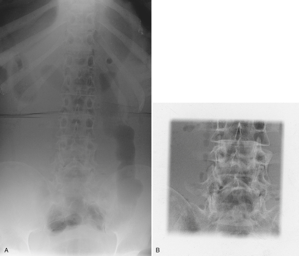 Radiography Essentials : For Limited Practice