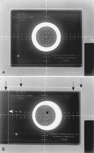 Radiography Essentials : For Limited Practice