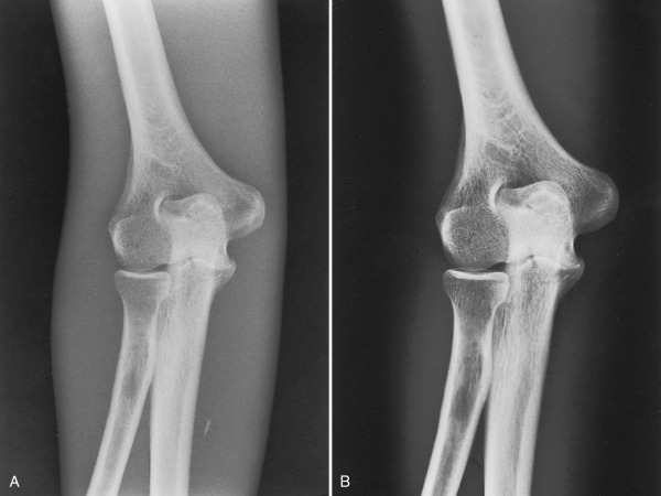 Radiography Essentials : For Limited Practice