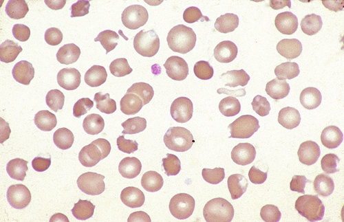 Dacie and Lewis Practical Haematology