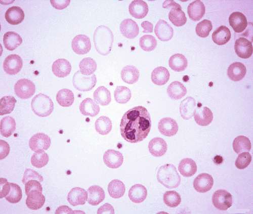 Dacie and Lewis Practical Haematology