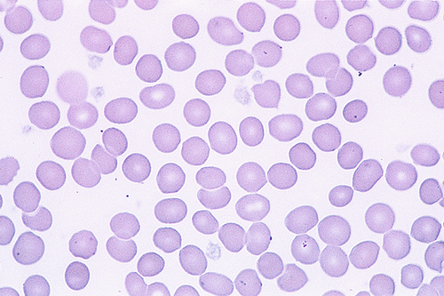 Dacie and Lewis Practical Haematology