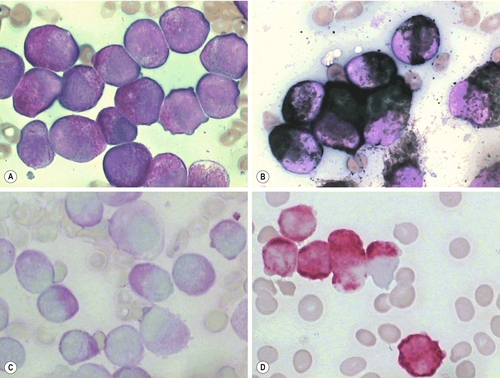 Dacie and Lewis Practical Haematology