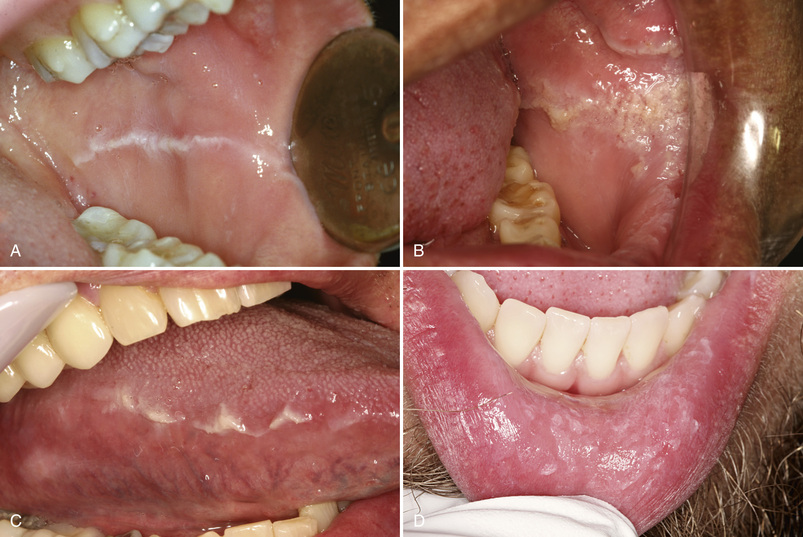 Oral pathology