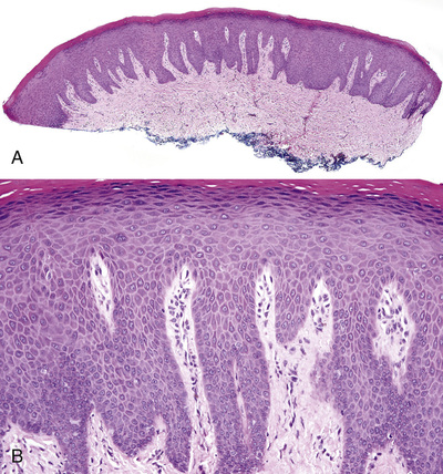Oral pathology