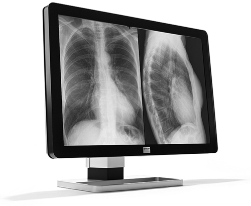 Radiographic Imaging and Exposure