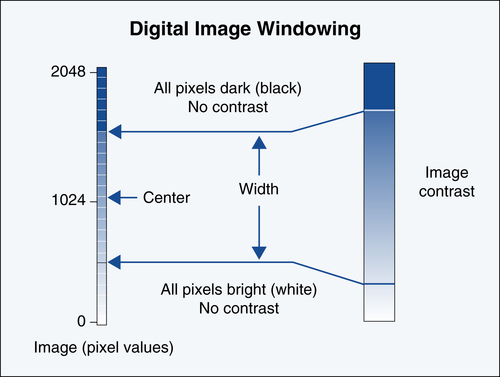 Radiographic Imaging and Exposure