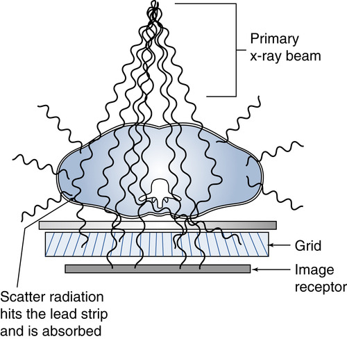 Radiographic Imaging and Exposure