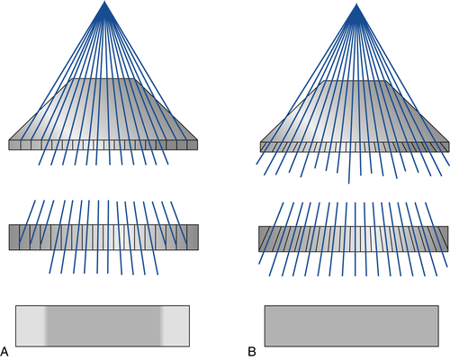 Radiographic Imaging and Exposure