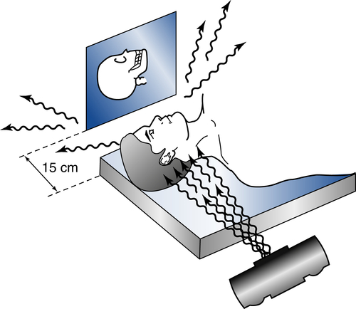 Radiographic Imaging and Exposure