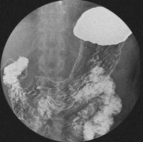 Radiographic Imaging and Exposure