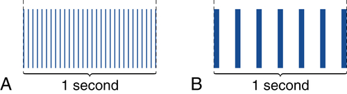 Radiographic Imaging and Exposure