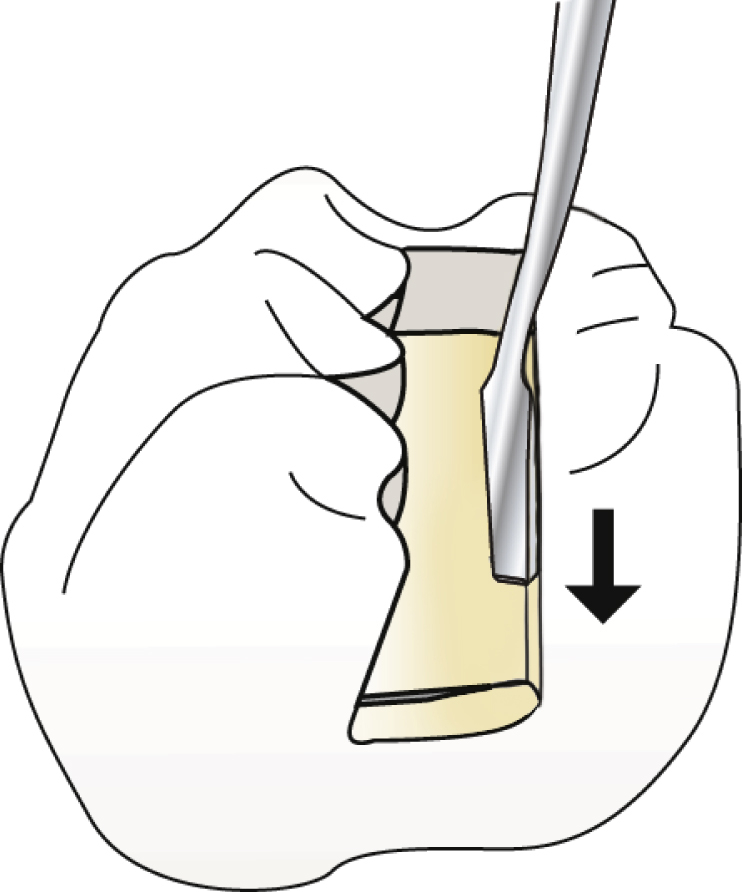 Dental Instruments