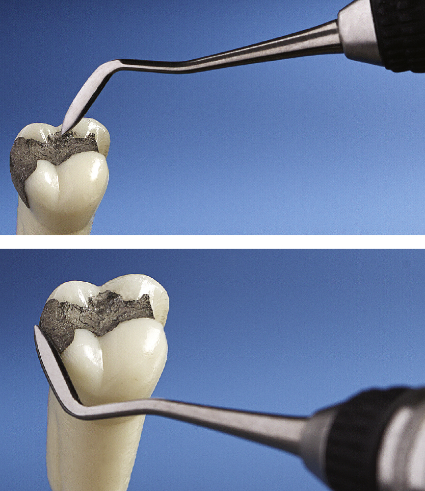 Dental Instruments
