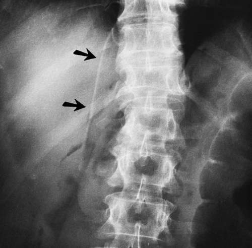 Comprehensive Radiographic Pathology