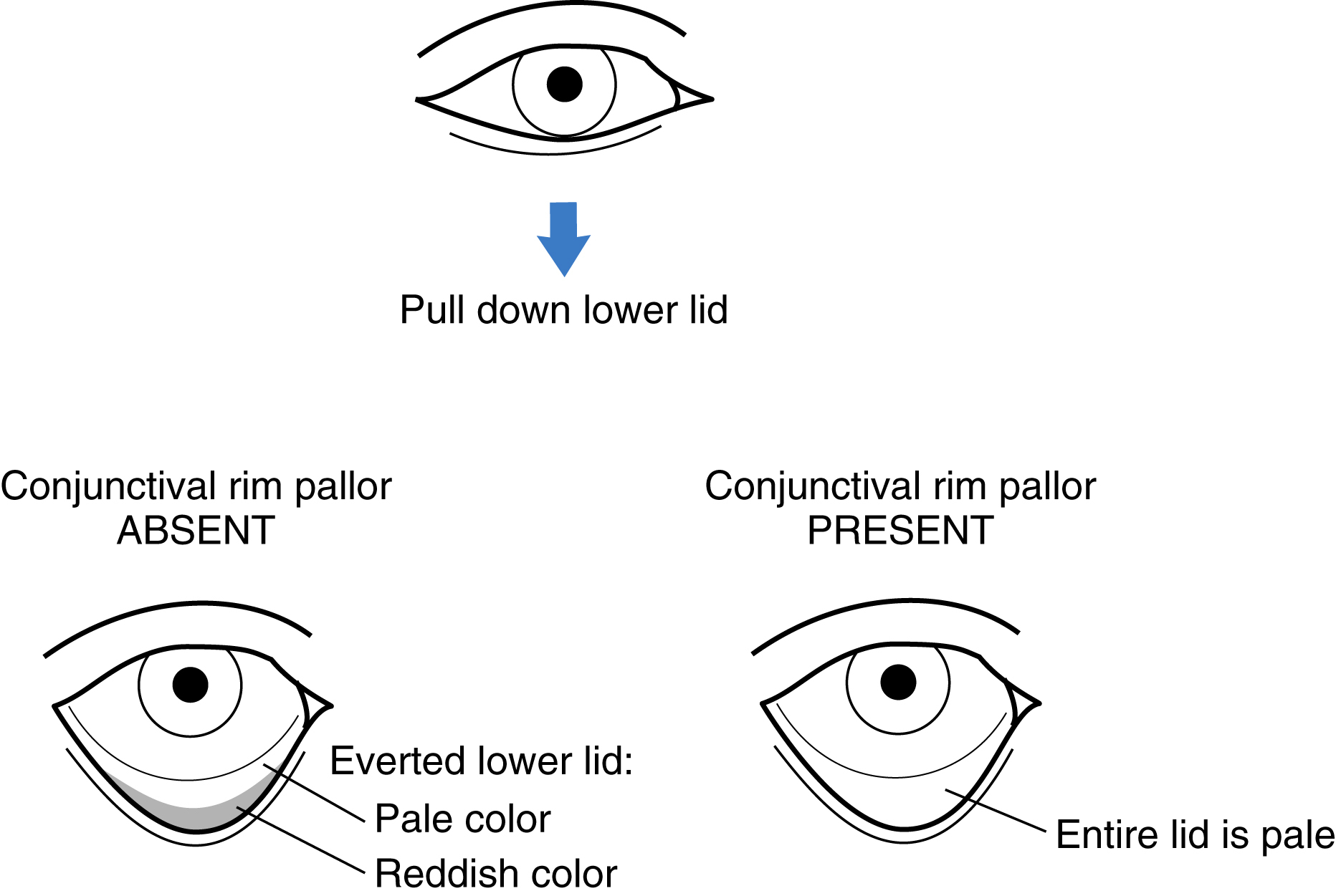 Evidence-Based Physical Diagnosis